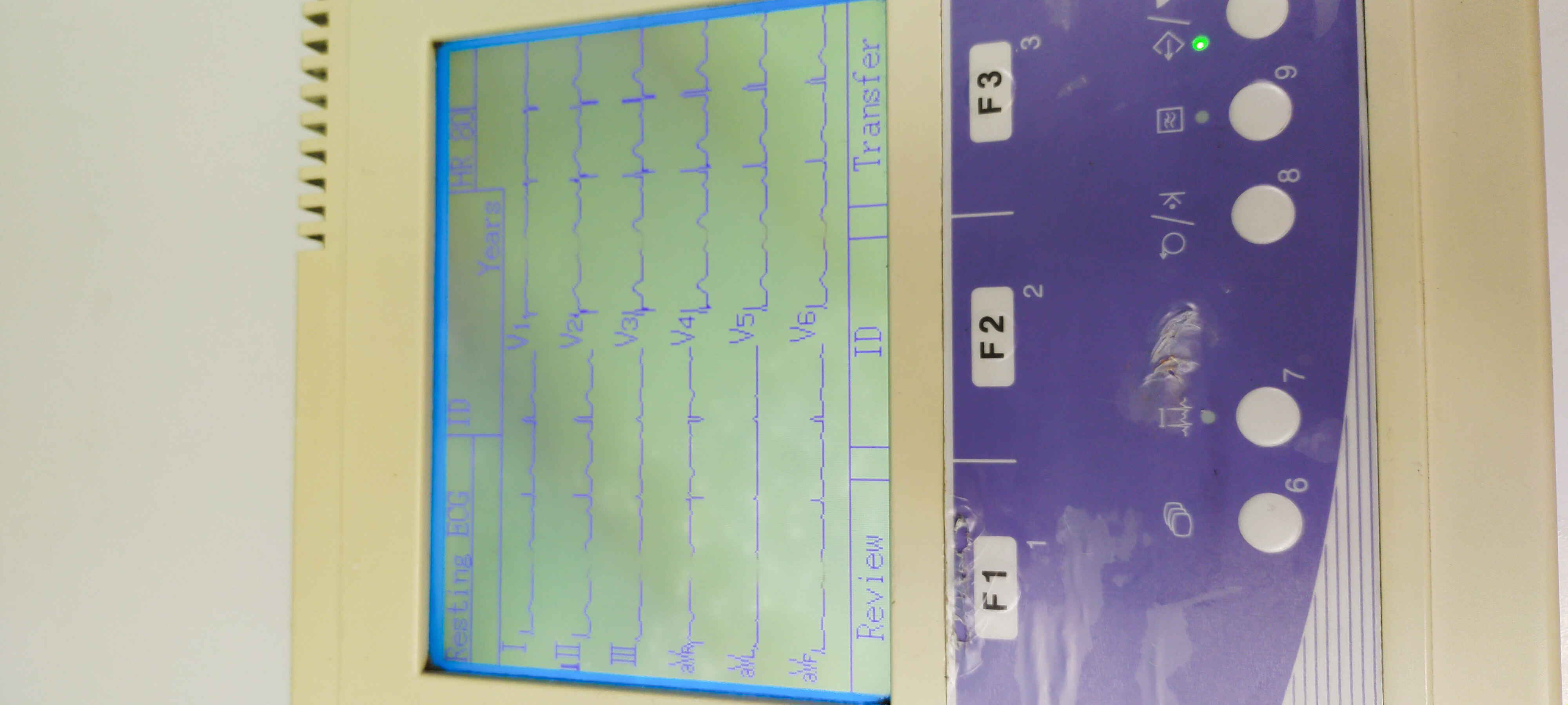 Nihon Kohden Cardiofax GEM EKG Gerät EKG Kabel