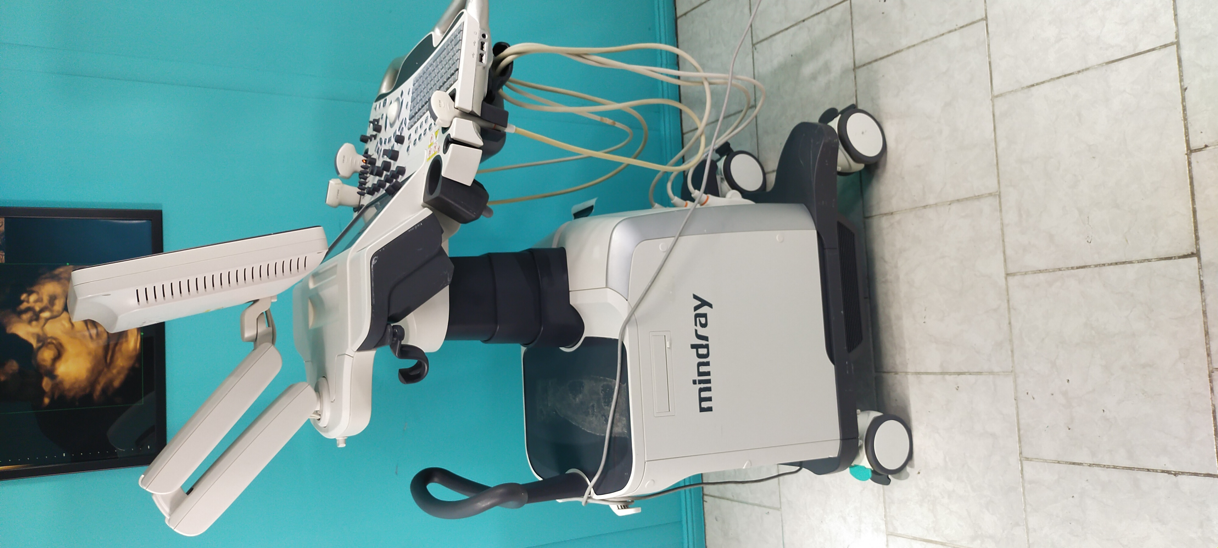 Mindray DC-8 Ultraschallgerät