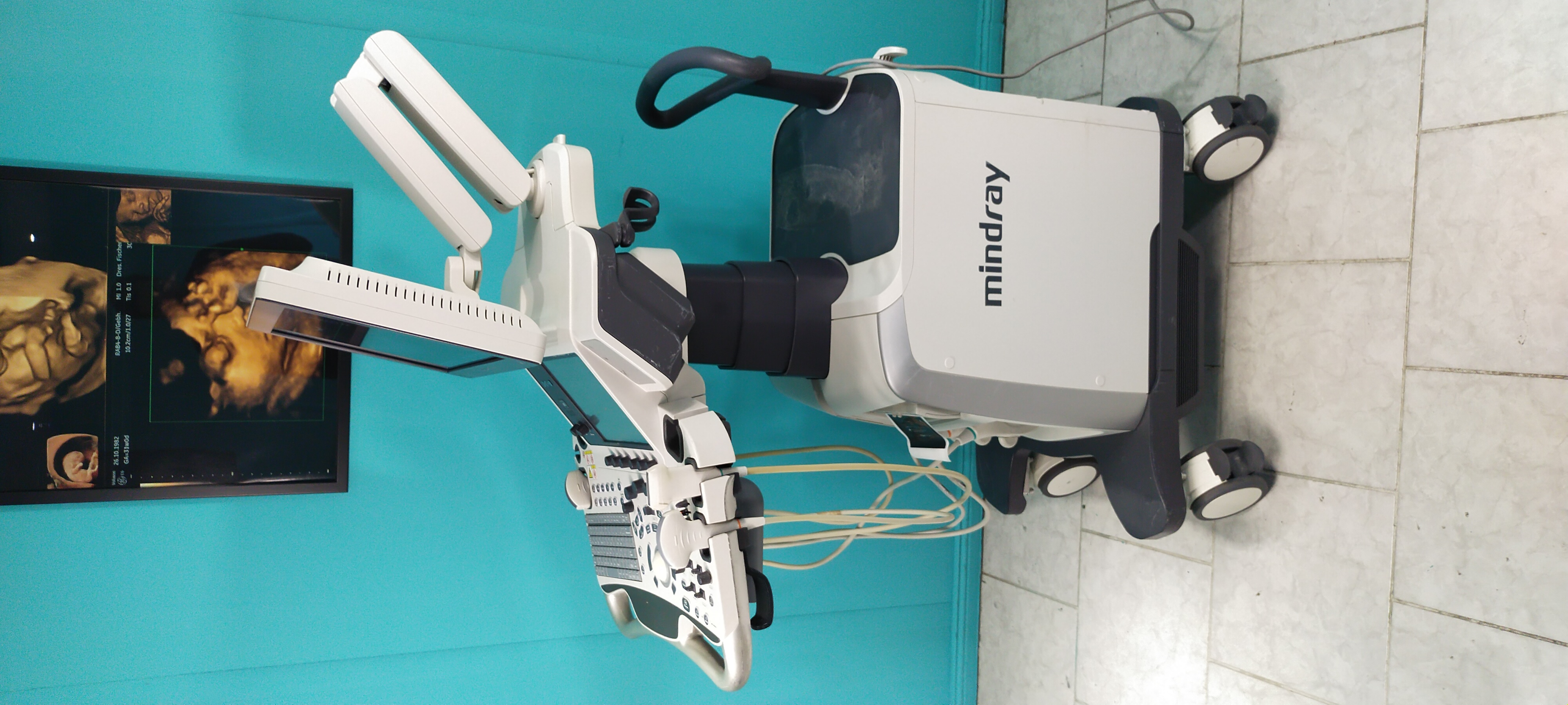 Mindray DC-8 Ultraschallgerät