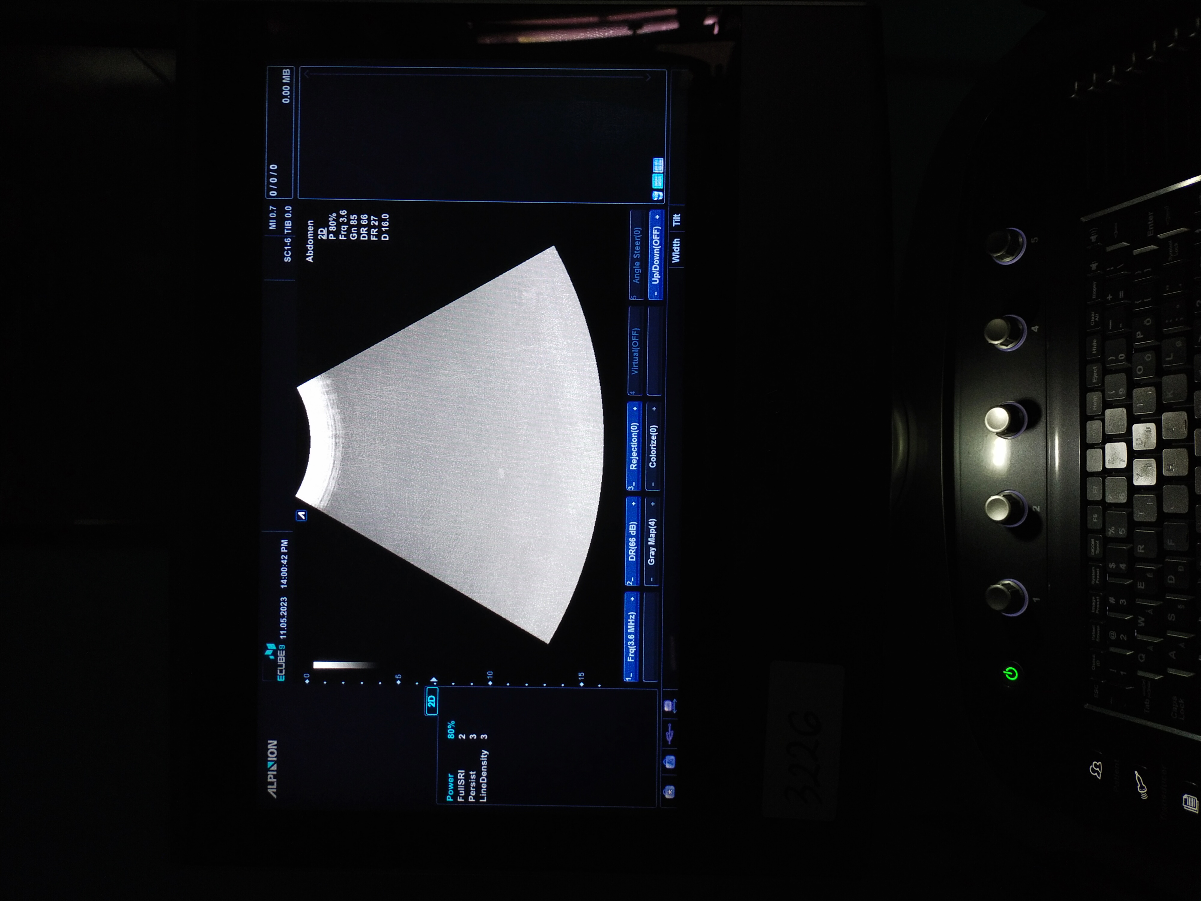 Alpinion E cube 9 Ultraschallgerät