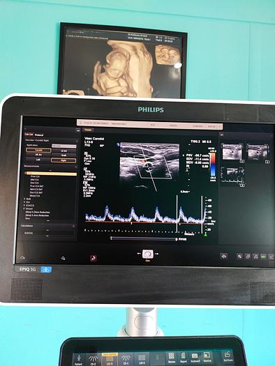 Gebraucht Philips Epiq 5G Flat Screen Ultrasound Scanner zum Verkauf in ...