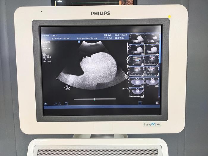 Philips, HD15, Ultraschallsystem, Purewave,