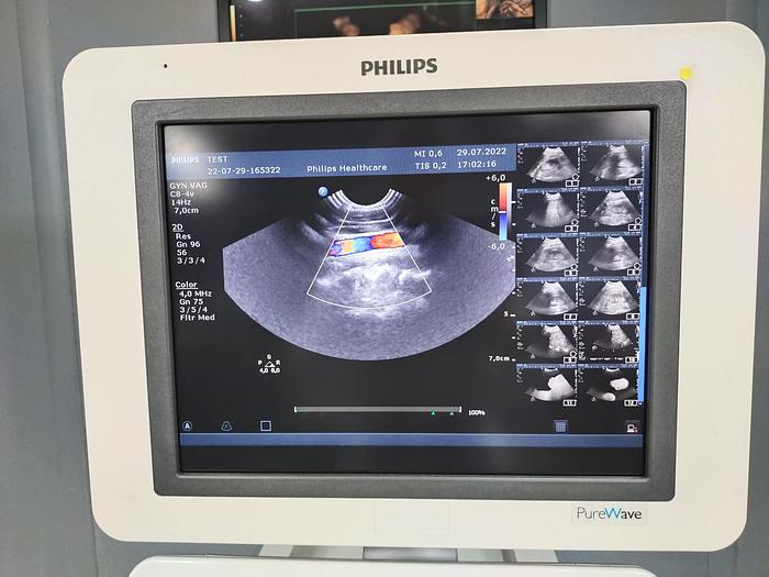 Philips, HD15, Ultraschallsystem, Purewave,