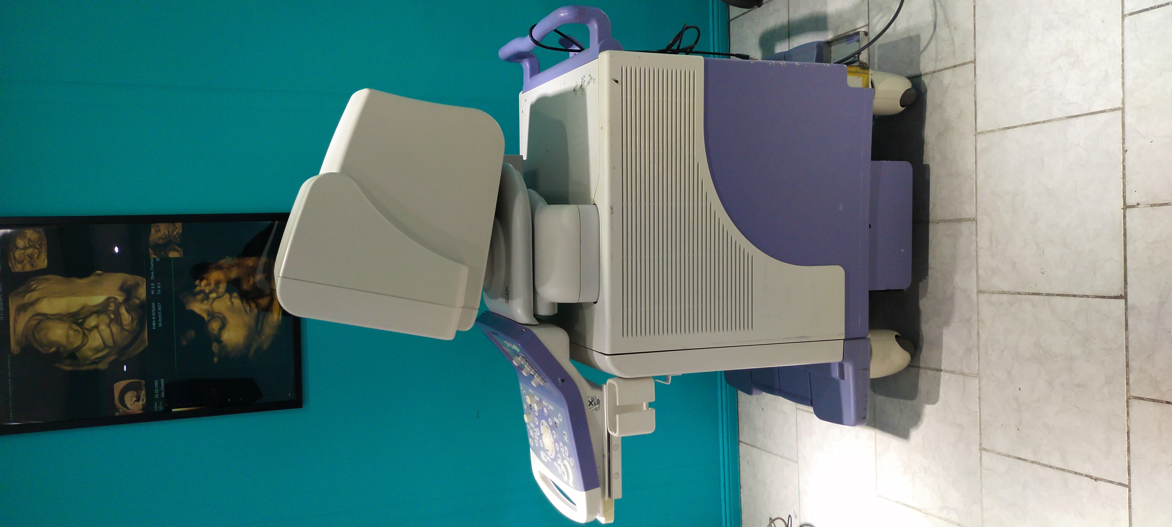 Aloka Prosound a10 Ultraschallgerät ultrasound scanner