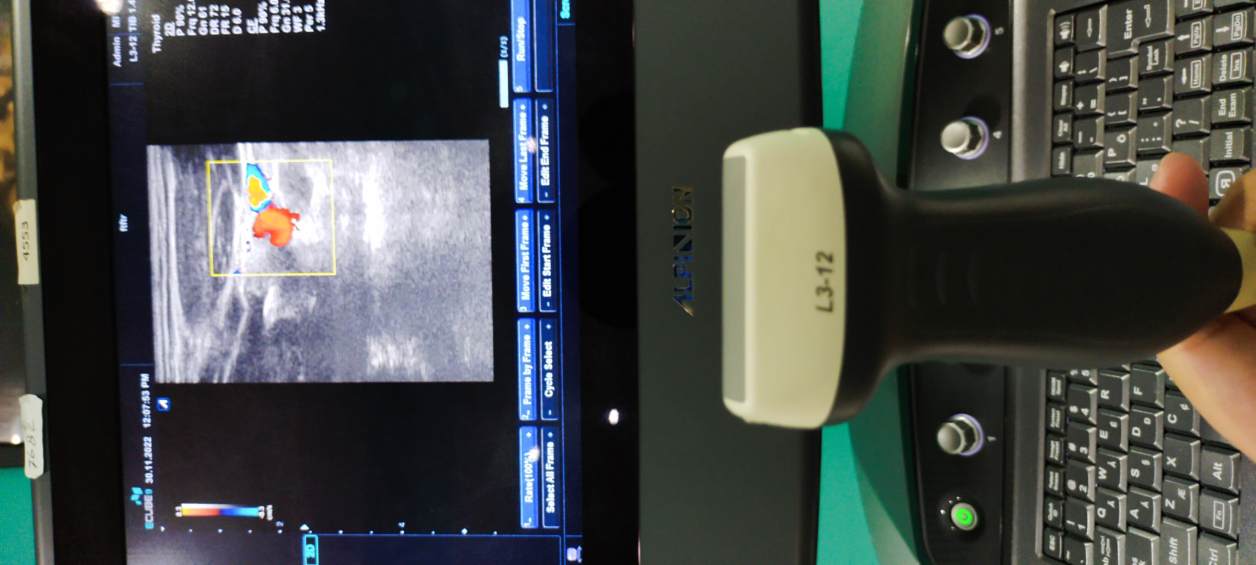 Alpinion E cube 9 Ultraschallgerät