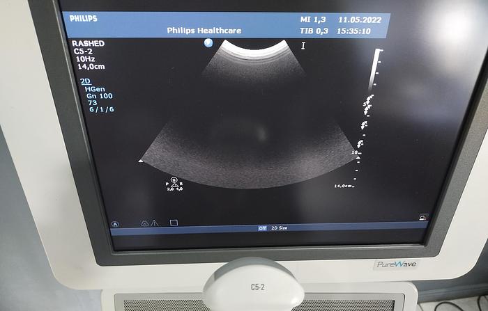 Philips, HD15, Ultraschallsystem, Purewave,