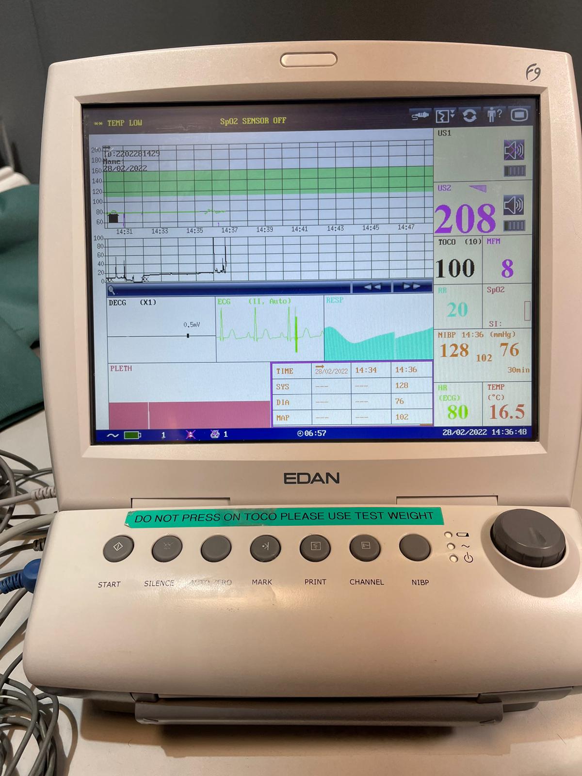 Gebraucht EDAN F9 EXPRESS Fetal Maternal Monitor mit Transducern und ...